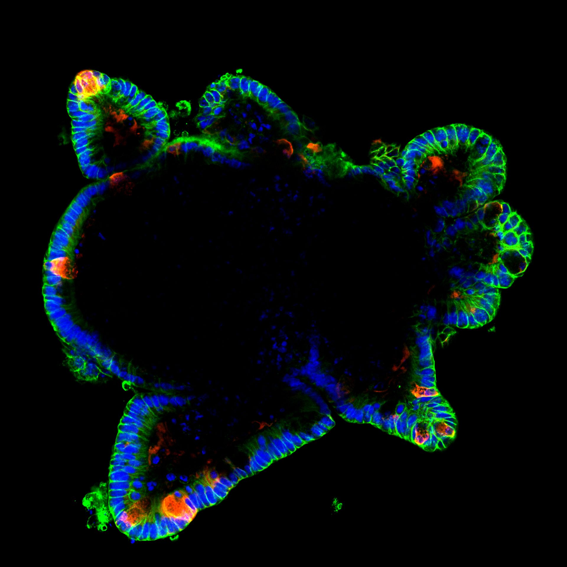 Neumann Lab - Institute of Microbiology, Infectious Diseases and Immunology